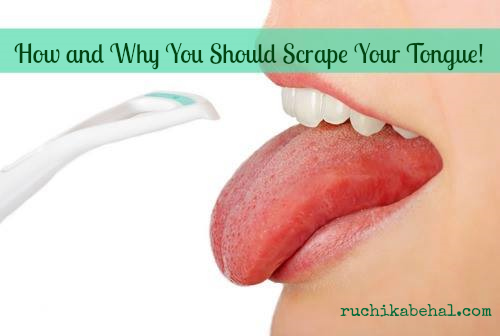 Do you clean your teeth every day? What about your tongue? Do you clean your teeth every day? What about your tongue?
